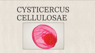 Cysticercus cellulosae at emaze Presentation