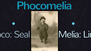 Phocomelia at emaze Presentation