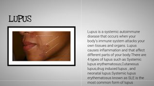 Lupus at emaze Presentation
