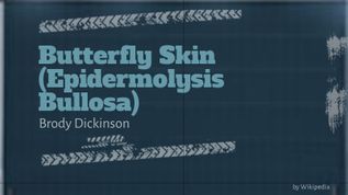 Butterfly Skin at emaze Presentation