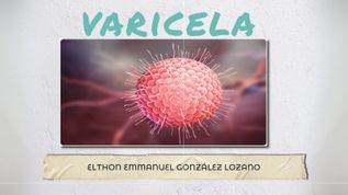 VARICELA at emaze Presentation