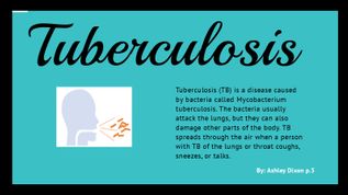 Tuberculosis at emaze Presentation