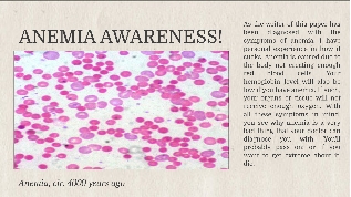 Anemia Awareness at emaze Presentation