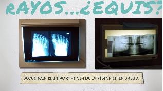 RAYOS...¿EQUIS? at emaze Presentation