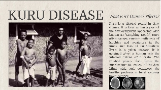 Kuru Disease at emaze Presentation