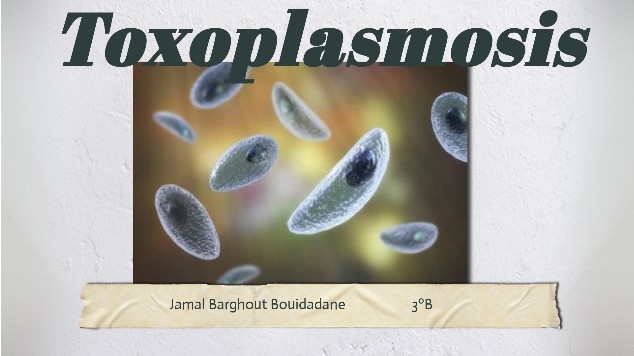 toxoplasmosis at emaze Presentation