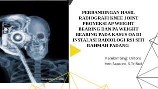 PERBANDINGANHASIL RADIOGRAFI KNEE JOINT PROYEKSI AP WEIGHT at emaze ...