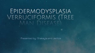 Epidermodysplasia Verruciformis (Tree Man Disease)kaykay and jerri.pptx ...