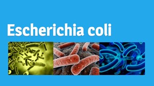 Escherichia coli.pptx copy1 at emaze Presentation