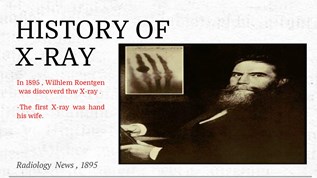 History of x-ray at emaze Presentation