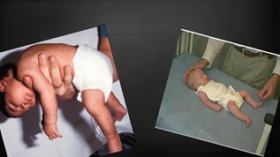 Floppy Infant at emaze Presentation