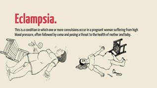 Eclampsia at emaze Presentation