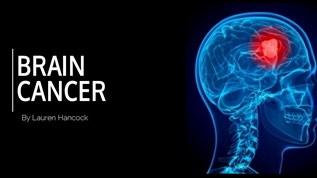 Brain Cancer at emaze Presentation