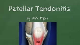 Patellar Tendonitis at emaze Presentation