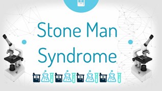 Stone Man Syndrome on emaze