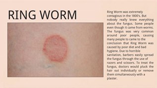 Ring Worm at emaze Presentation