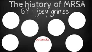 The history of MRSA at emaze Presentation
