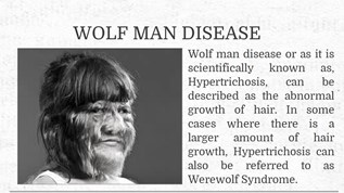 Wolf Man Disease at emaze Presentation