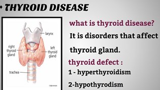 metabolic defects at emaze Presentation