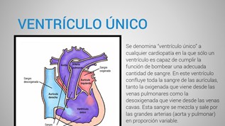 VENTRÍCULO ÚNICOSe at emaze Presentation