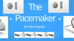 The Pacemaker at emaze Presentation