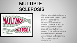 Multiple sclerosis at emaze Presentation