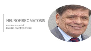 Also Known As NF at emaze Presentation