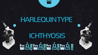 HARLEQUIN TYPE at emaze Presentation