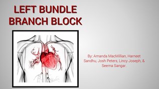Left Bundle branch at emaze Presentation