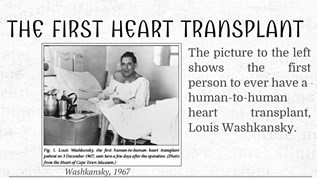 The First Heart Transplant at emaze Presentation