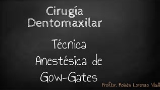 Técnica de Gow Gates at emaze Presentation