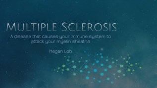 Multiple Sclerosis at emaze Presentation