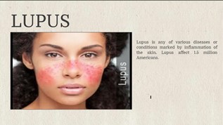 Lupus at emaze Presentation