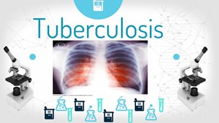 Tuberculosis at emaze Presentation