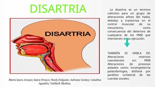 DISARTRIA La at emaze Presentation