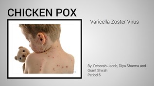Chickenpox Varicella at emaze Presentation