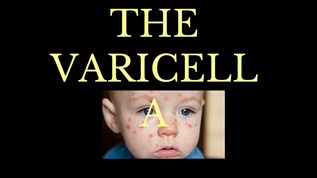 THE VARICELLA at emaze Presentation
