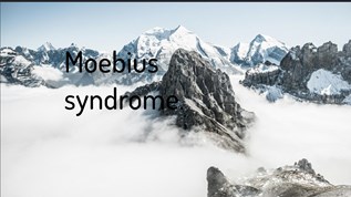 Moebius syndrome. at emaze Presentation