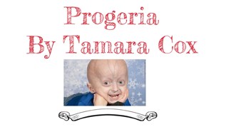 Progeria on emaze