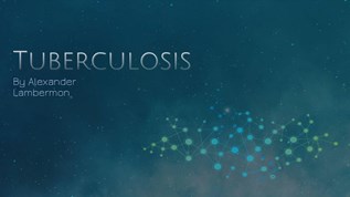 Tuberculosis at emaze Presentation