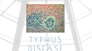 TYPHUS DISEASE at emaze Presentation