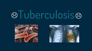 Tuberculosis at emaze Presentation