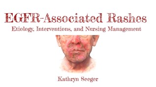 EGFR-Associated Rashes at emaze Presentation