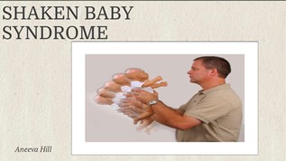 Shaken baby syndrome at emaze Presentation