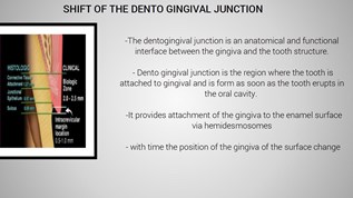 shift of dento gingival at emaze Presentation
