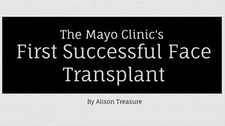 First Successful Face Transplant at emaze Presentation