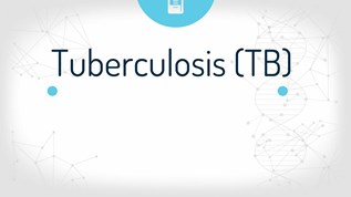 Tuberculosis at emaze Presentation